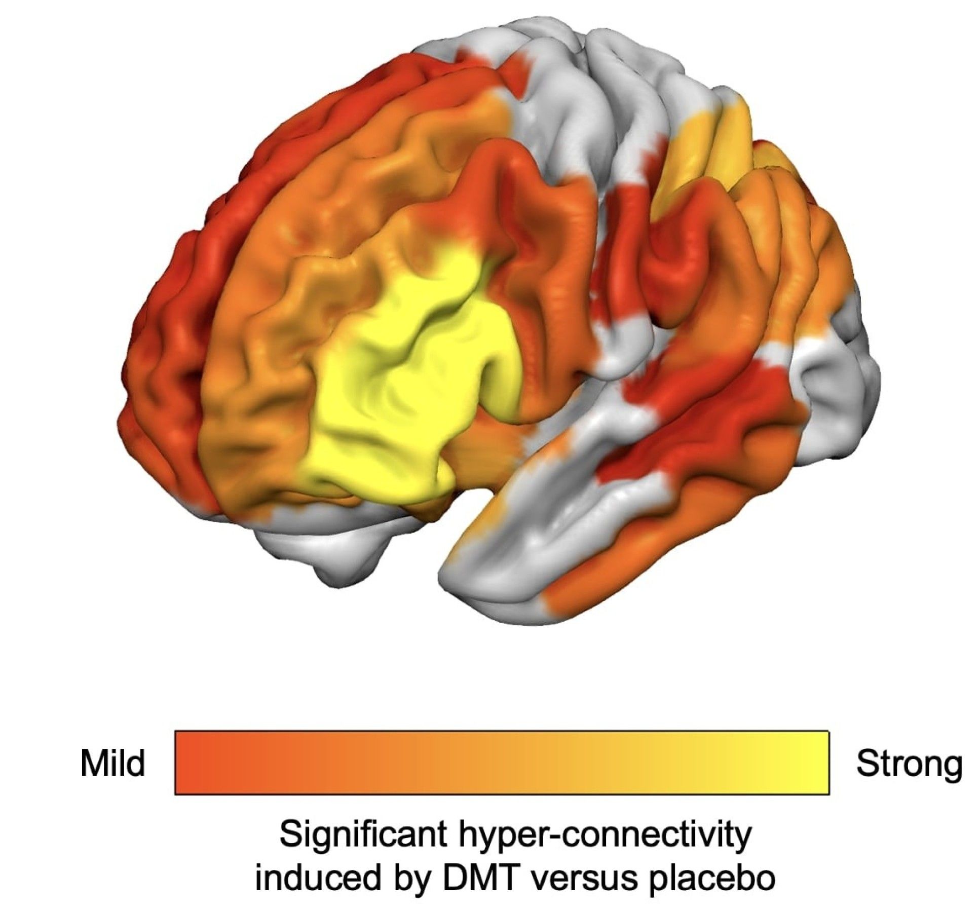 First map showing how psychedelics affect the brain published